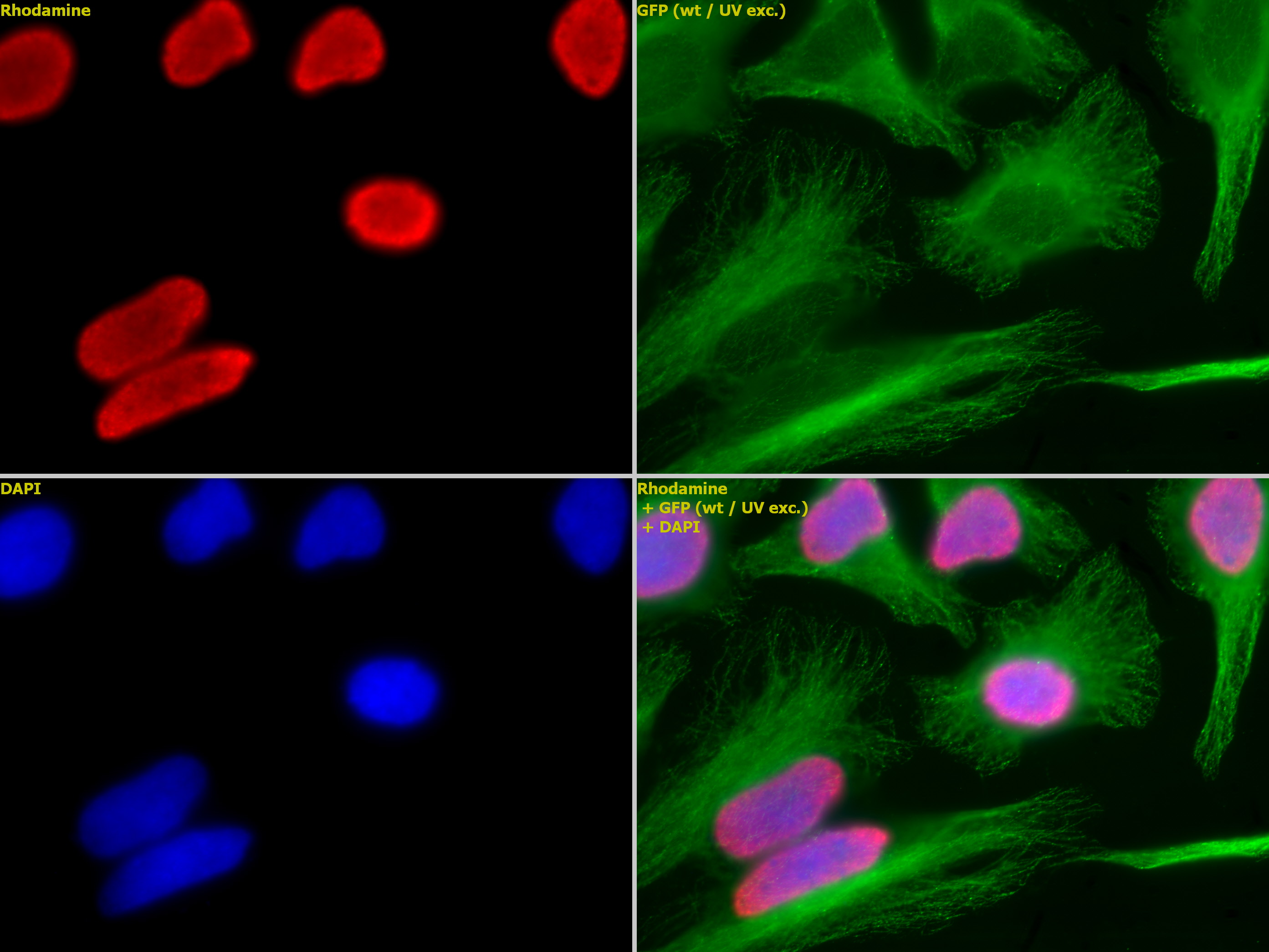 Histone H3k18ac Antibody Pab United Bio Research