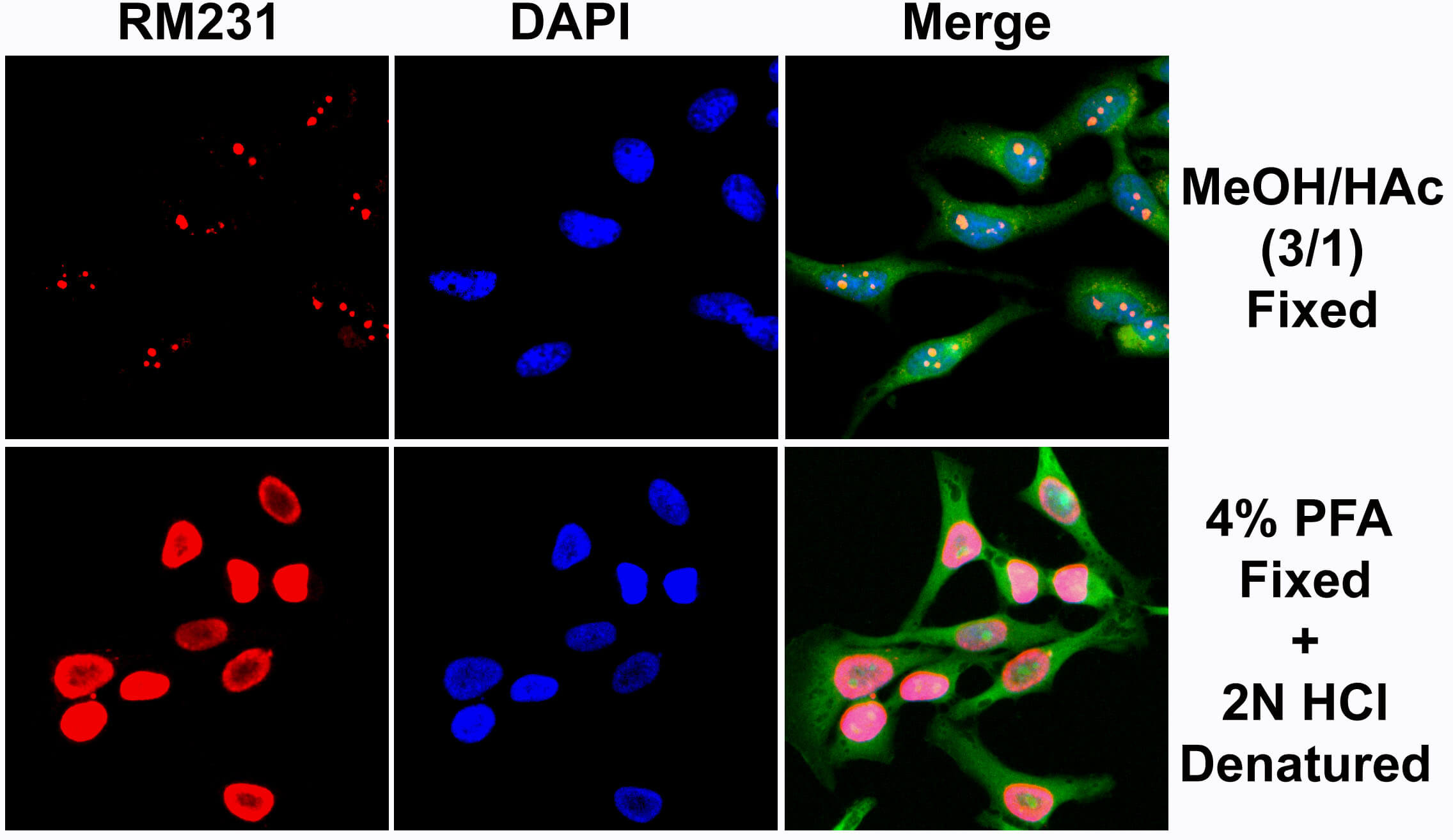 5-Methylcytosine (5-mC) antibody (rAb) - United Bio Research 5-Methylcytosine (5-mC) antibody (rAb) - United Bio Research